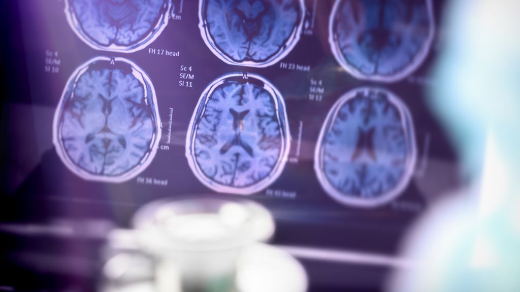 Neuro Hospitals